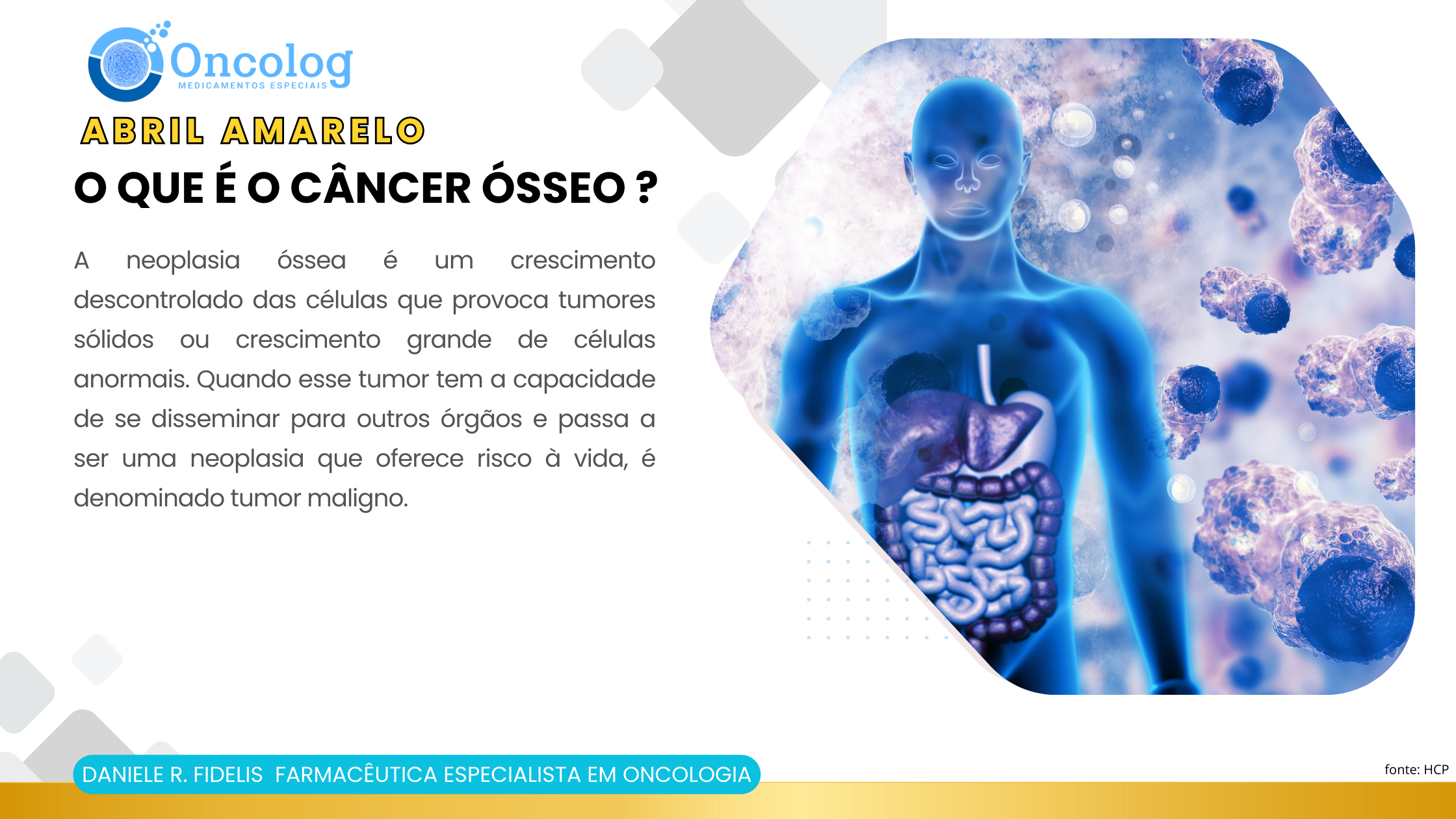O que é o Câncer Osseo - Oncolog Medicamentos Especiais