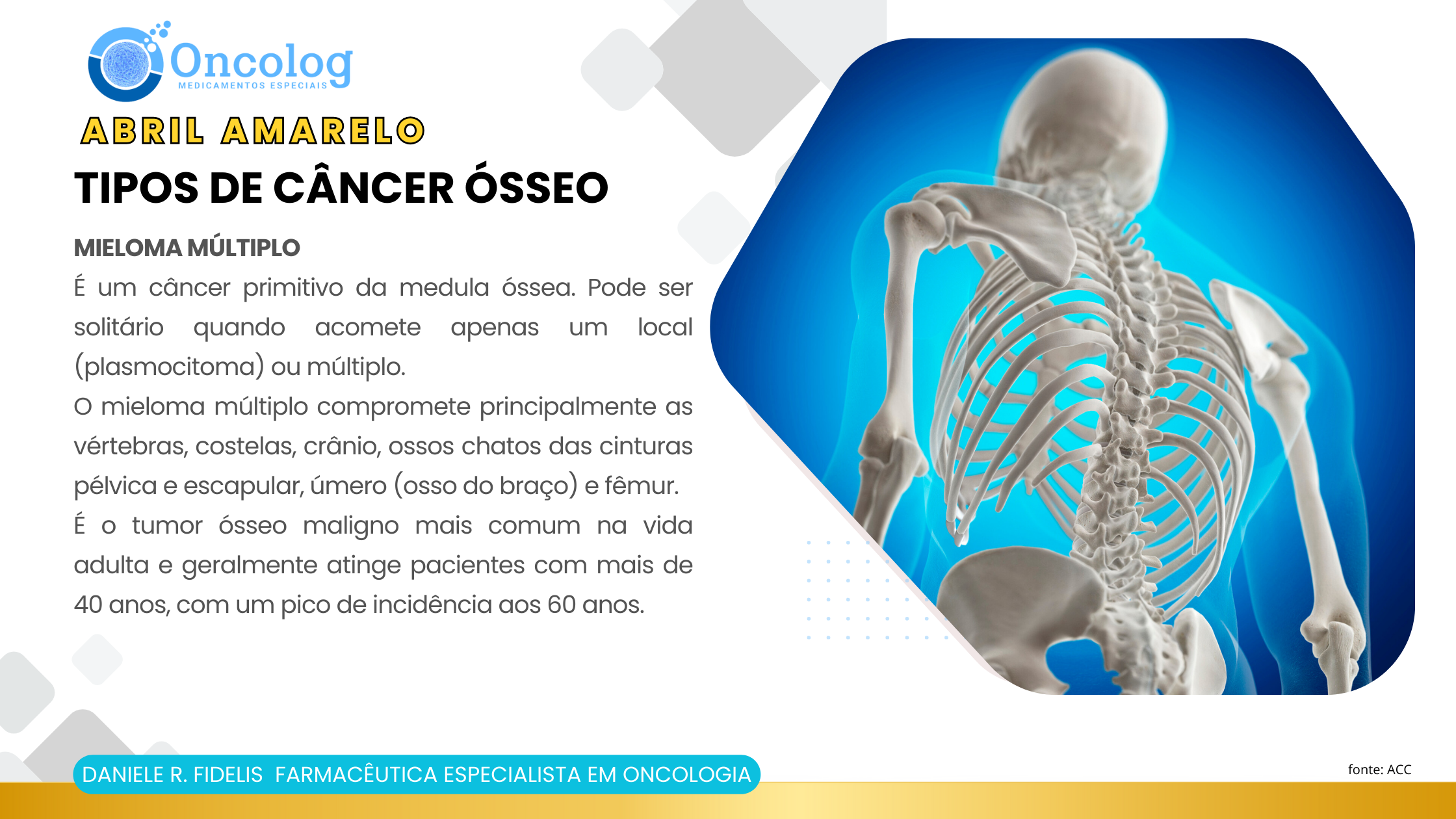 Tipos de câncer ósseo Mieloma múltiplo - Oncolog Medicamentos Especiais